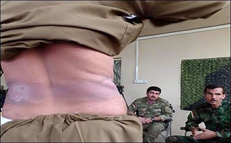 ISIS chemical weapons a global threat | Rudaw.net