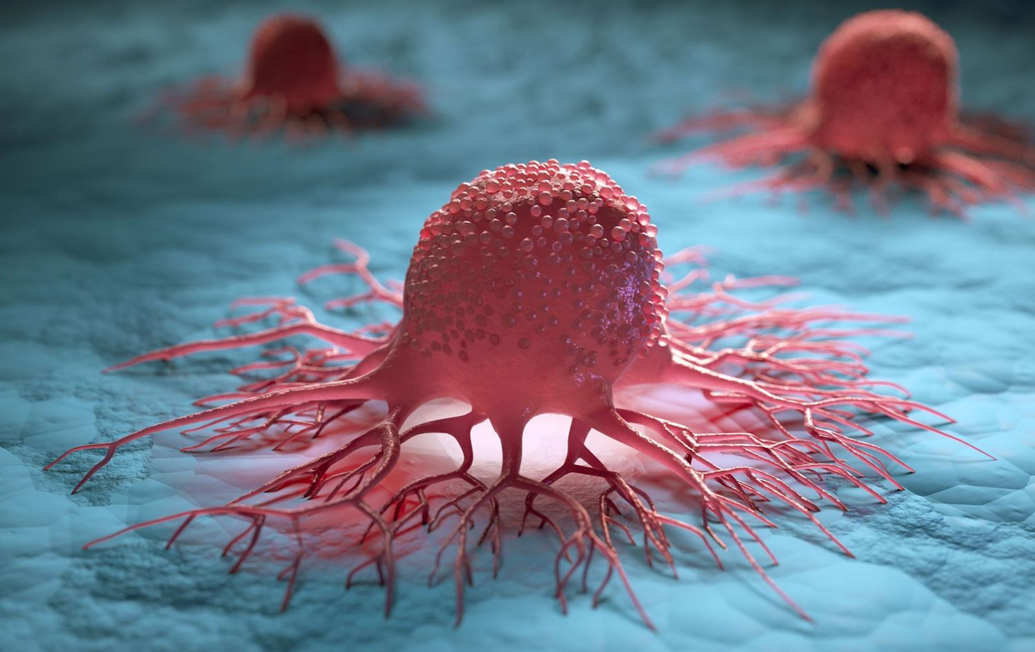 هۆشداری لەبارەی هەڵکشانی رێژەی تووشبوون بە... | رووداو.نێت